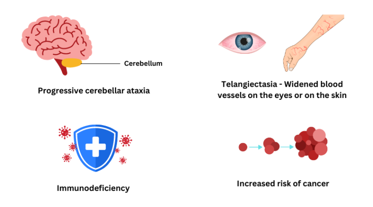 Ataxia-Telangiectasia (A-T) – Rare Awareness Rare Education